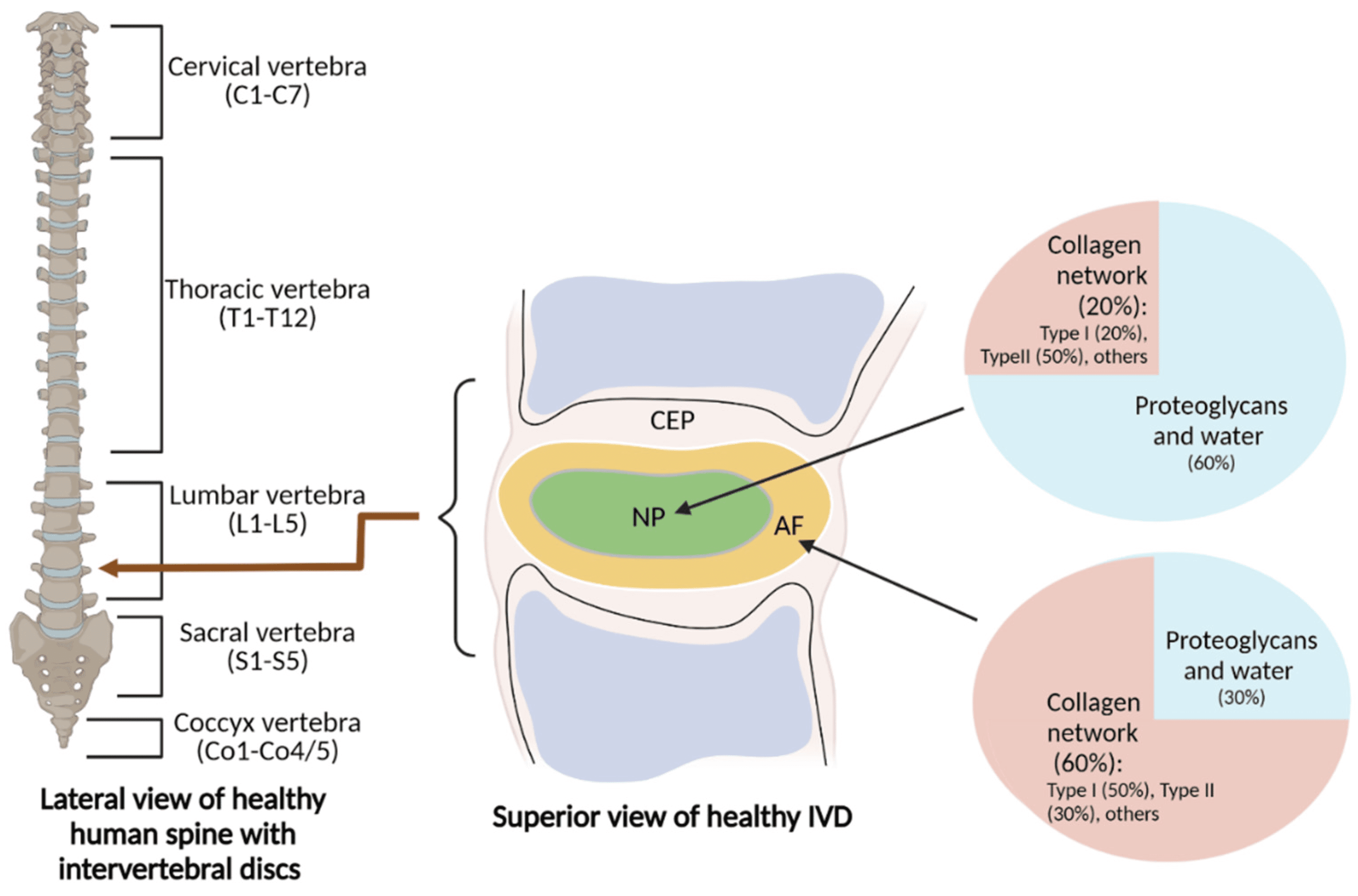 Understanding The Role Of Genetics In Disc Protrusion