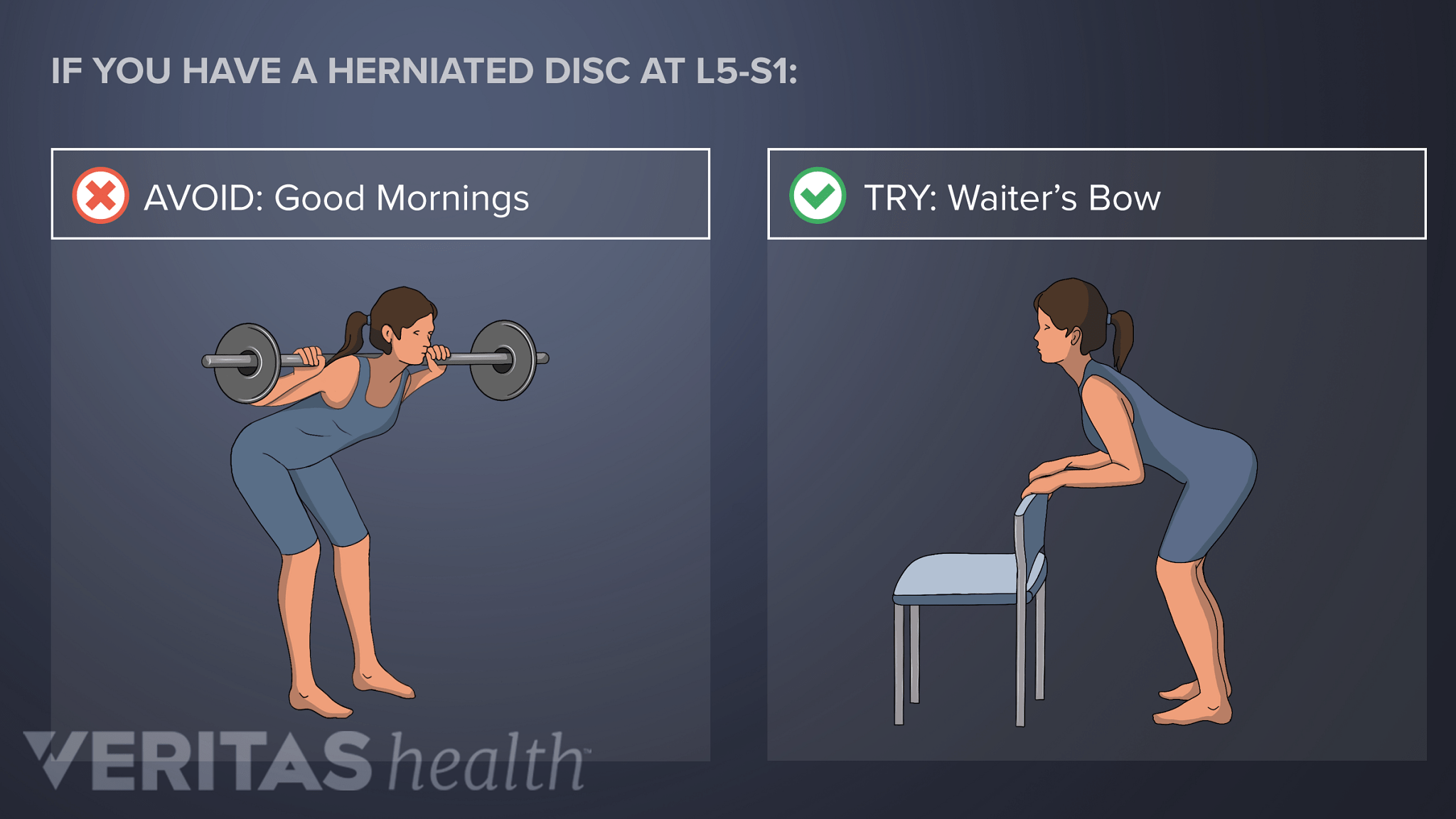 Top Ways To Prevent Disc Protrusion During Exercise