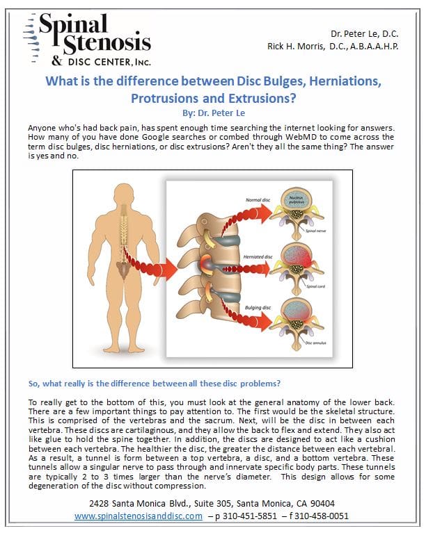 Exploring Gender Differences In The Experience Of Disc Protrusion